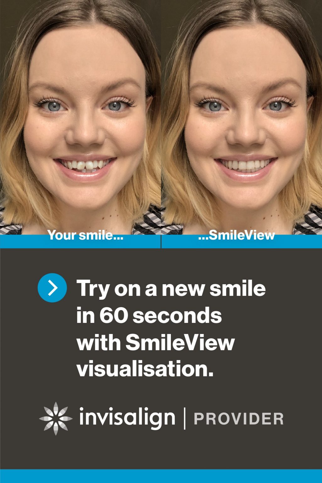 Invisalign - Langley Road Dental Practice